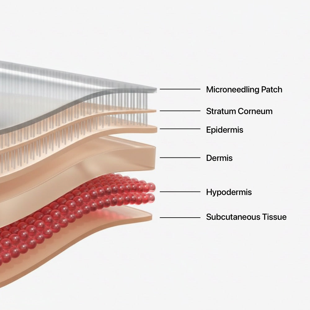 Microneedle Patches for Wrinkles & Dark Circles with Peptides, Collagen ...